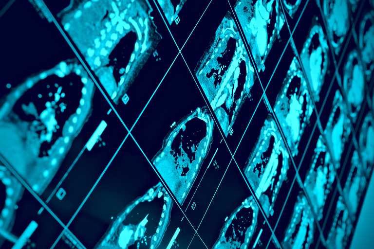 Pulmonary and Critical Care Fellowship Program | Montefiore Einstein