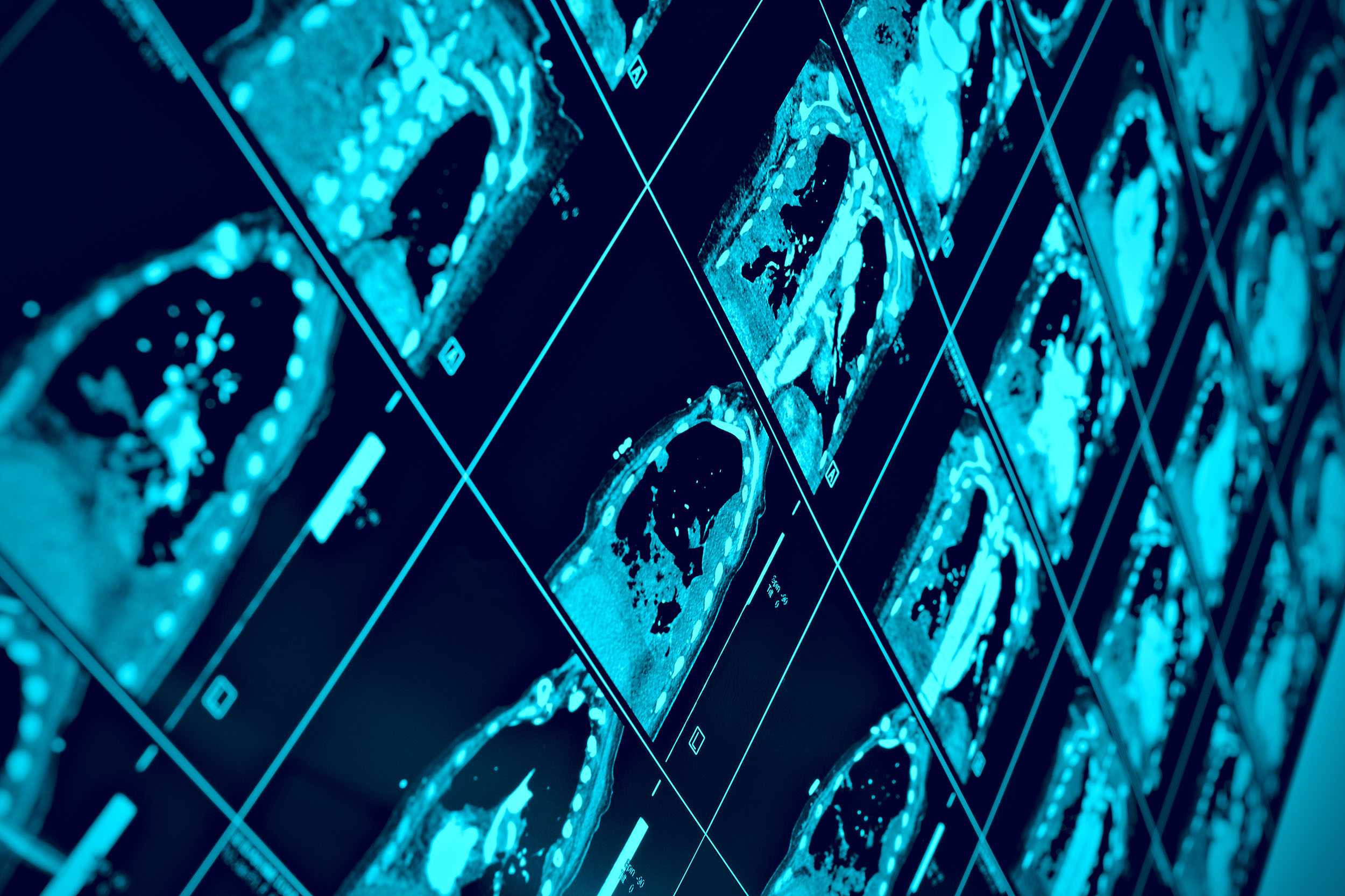 Pulmonary and Critical Care Fellowship Program | Montefiore Einstein