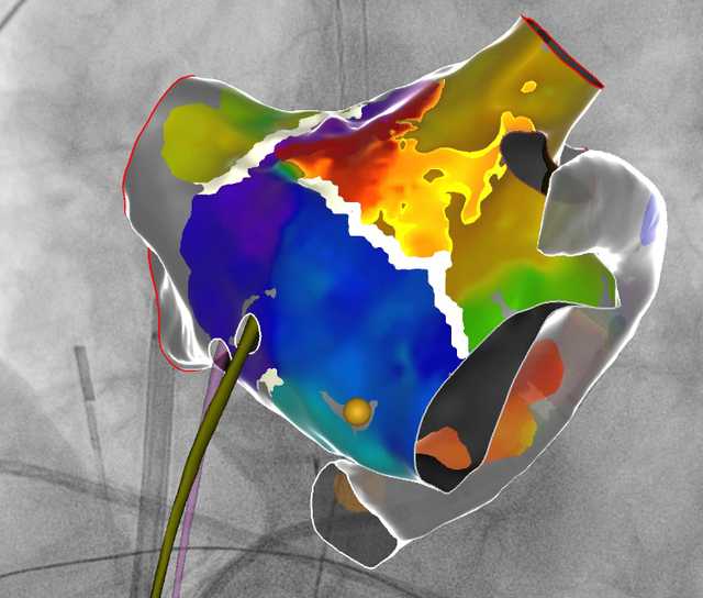 Cardiology Fellowship Program Virtual Tour | Montefiore Einstein